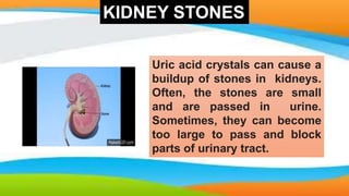 Uric acid and related Disorders | PPTX