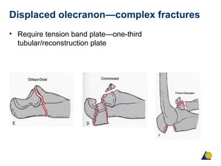 Olecranon patella | PPT