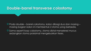 Macam-macam Stoma Intestinal dan pembuatannya.pptx