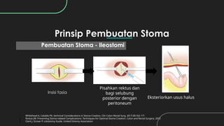 Macam-macam Stoma Intestinal digestiv.pptx