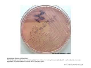 MACCONKEY-AGAR-PLATES for microbiology.pptx