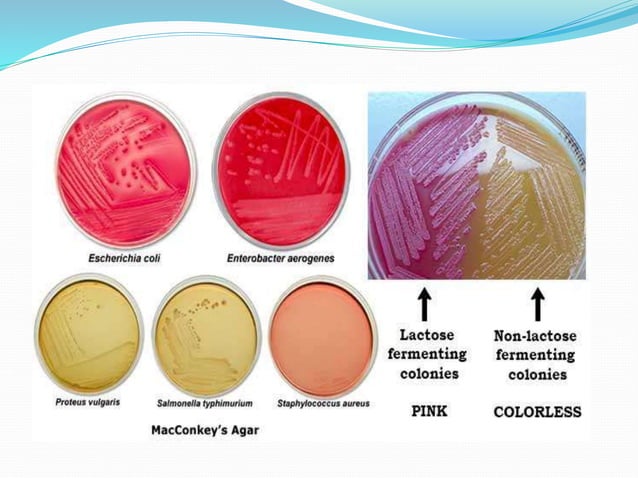 Mac conkey agar presentation | PPTX