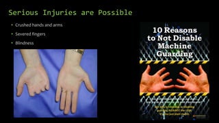 Machine guarding | PPTX | First Aid | Injuries
