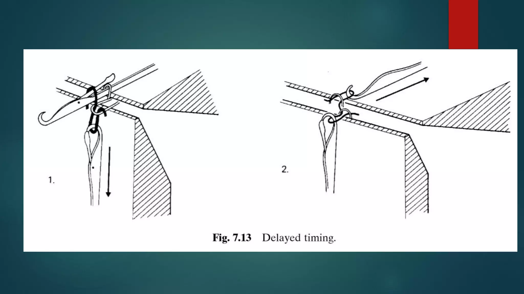 knitting Machine parts, knittging action & cam system | PDF