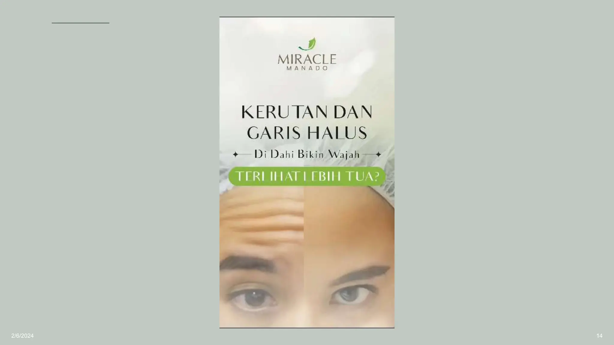 MAC MDC - general presentasi klinik miracle.pptx