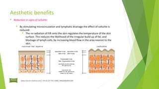 MACOM Smooth Research | PPT