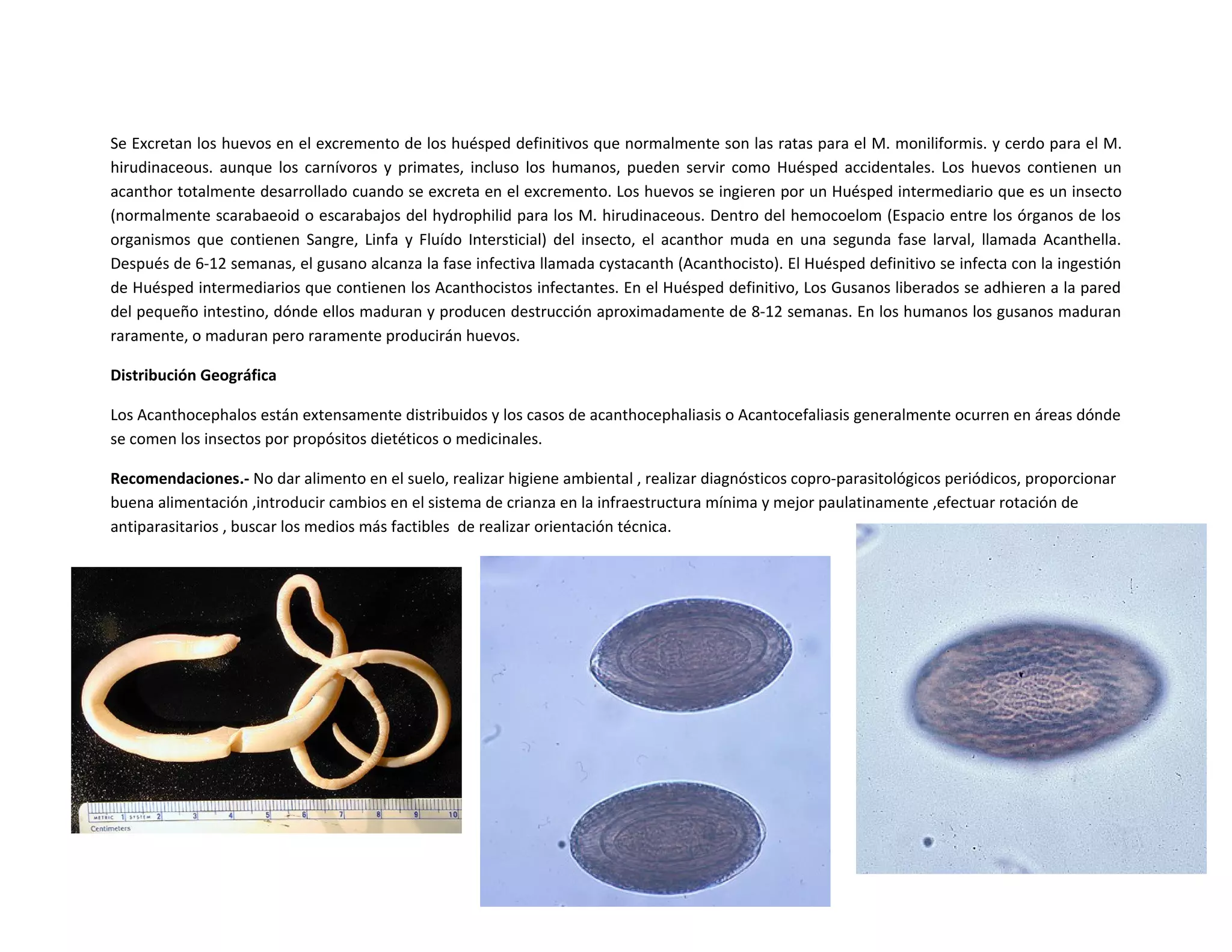 Macracanthorhynchus Hirudinaceous