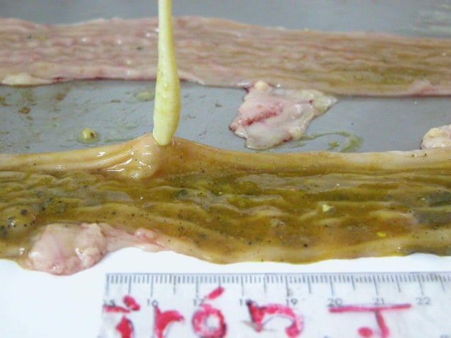 Macracanthorhynchus hirudinaceus | PDF