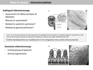 Monitoring macro and microcirculation (Joel Starkopf WSACS session ESA ...