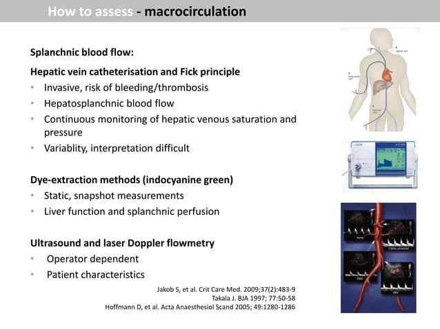 Monitoring Macro And Microcirculation Joel Starkopf Wsacs Session Esa