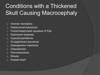 Approach to Macrocephaly / large head, Megalencephaly, Causes(Etiology ...