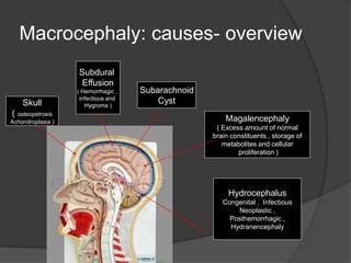 Approach to Macrocephaly / large head, Megalencephaly, Causes(Etiology ...