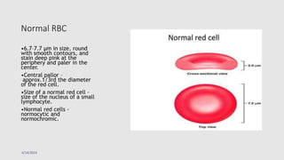 Features of megaloblastic and non megaloblastic anemia | PPTX