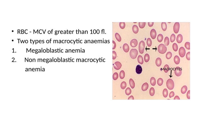 macrocytic anemia megaloblastic and nonmegaloblastic .pptx