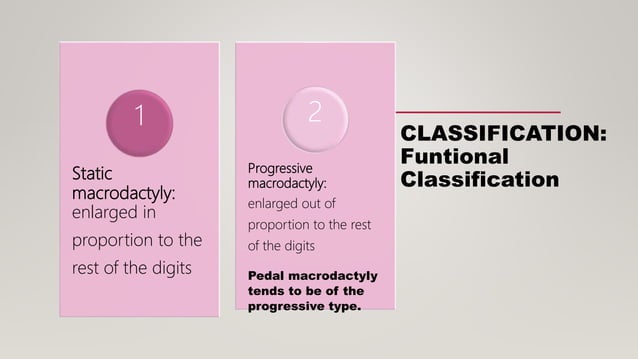 Macrodactyly A rare anomaly | PPT