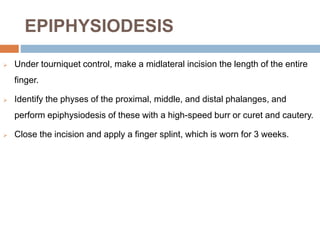 Macrodactyly presentation | PPTX