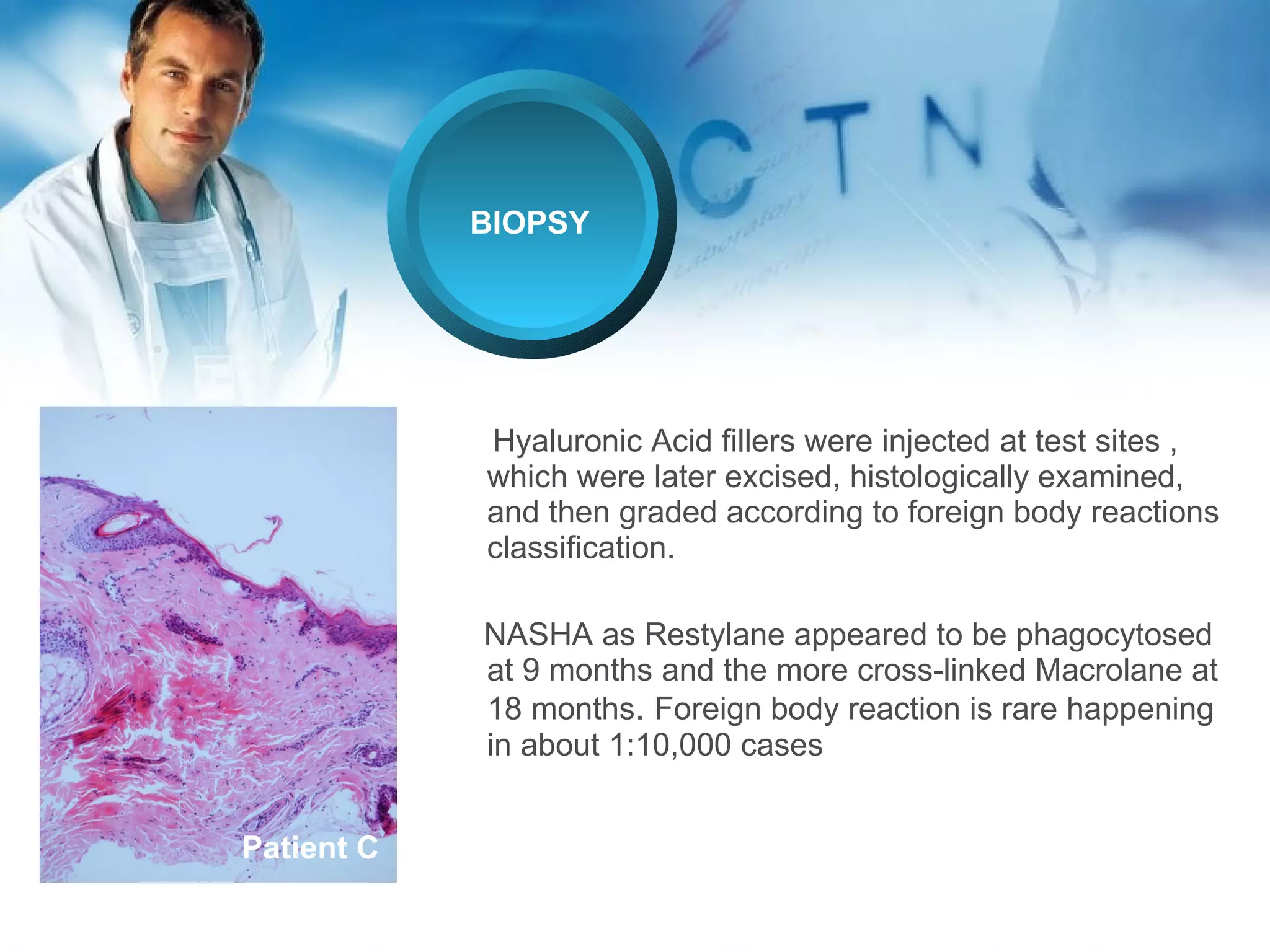 Macrolane for Breast Contouring | PPT