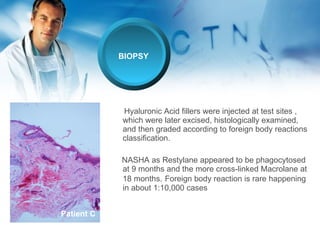 Macrolane for Breast Contouring | PPT