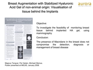 Macrolane Breast Enhancement - Paris | PPT