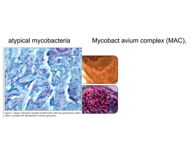 Macrolide antibiotics | PPT