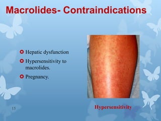 Macrolides | PPTX