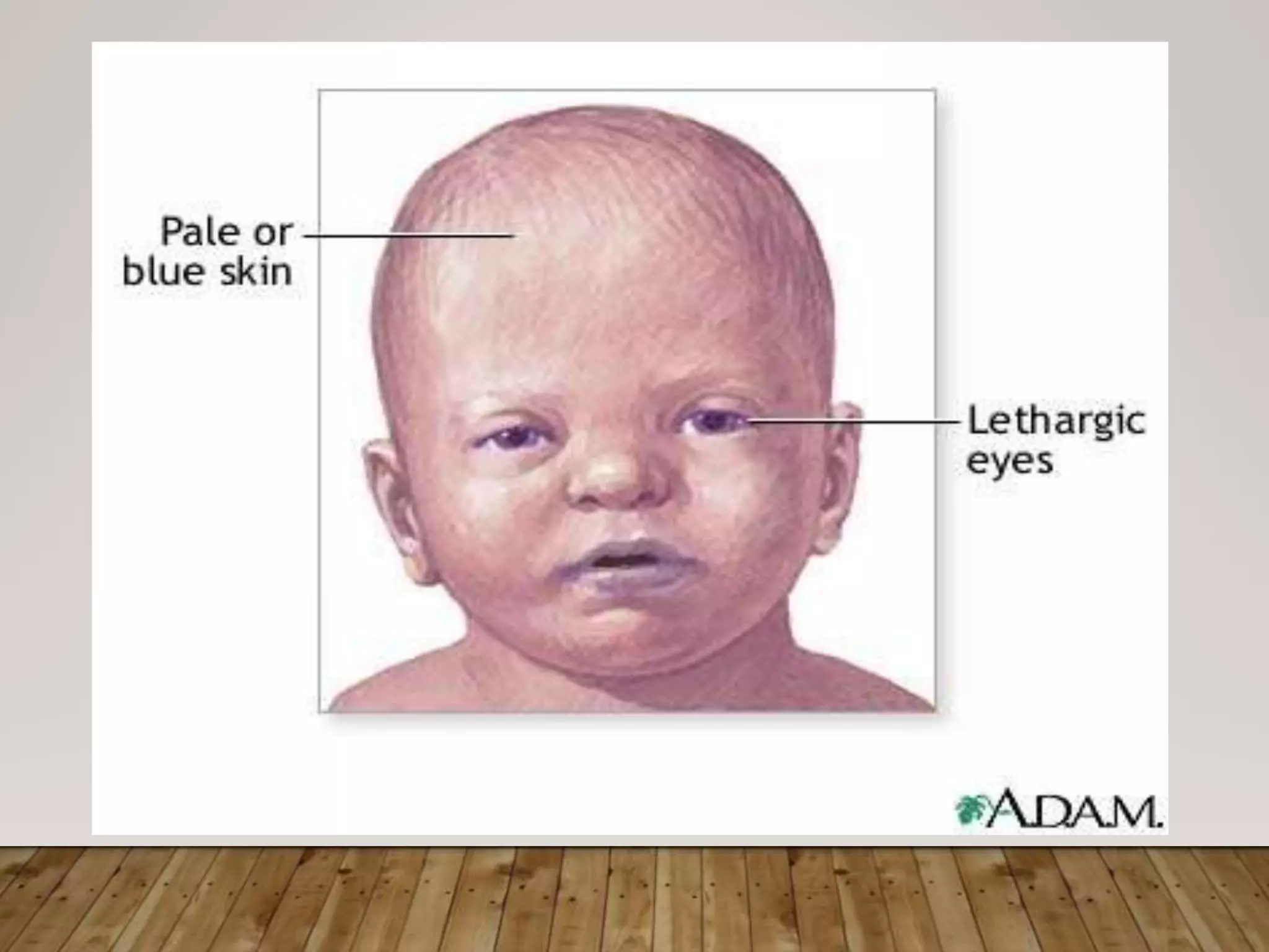 Macrolides, Fluoroquinolones and Broad spectrum antibiotics.pptx