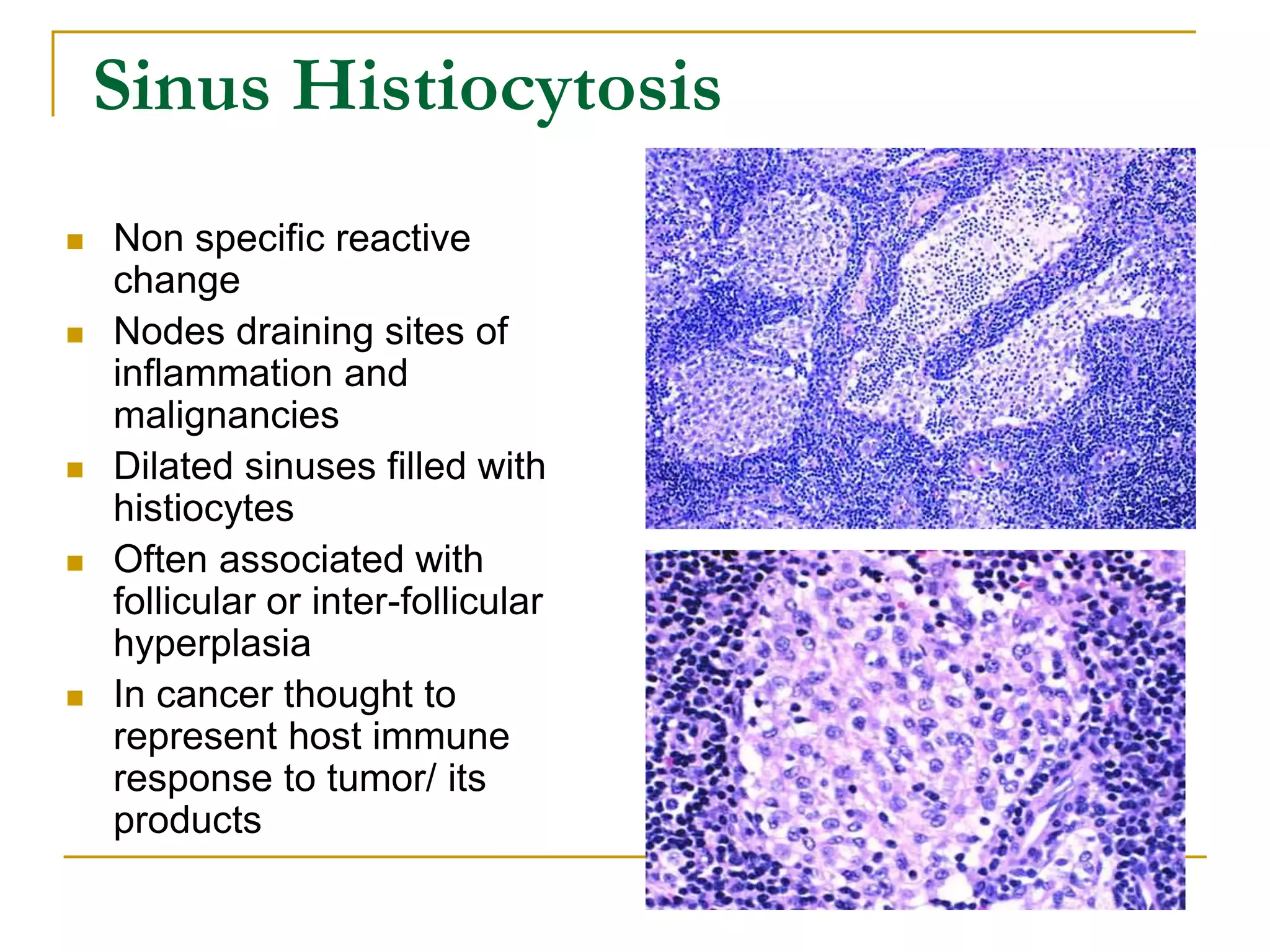 Macrophage in Health and Disease.ppt