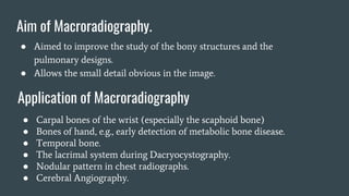 MACRORADIOGRAPHY.pptx