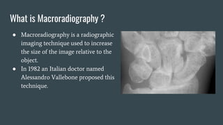 MACRORADIOGRAPHY.pptx