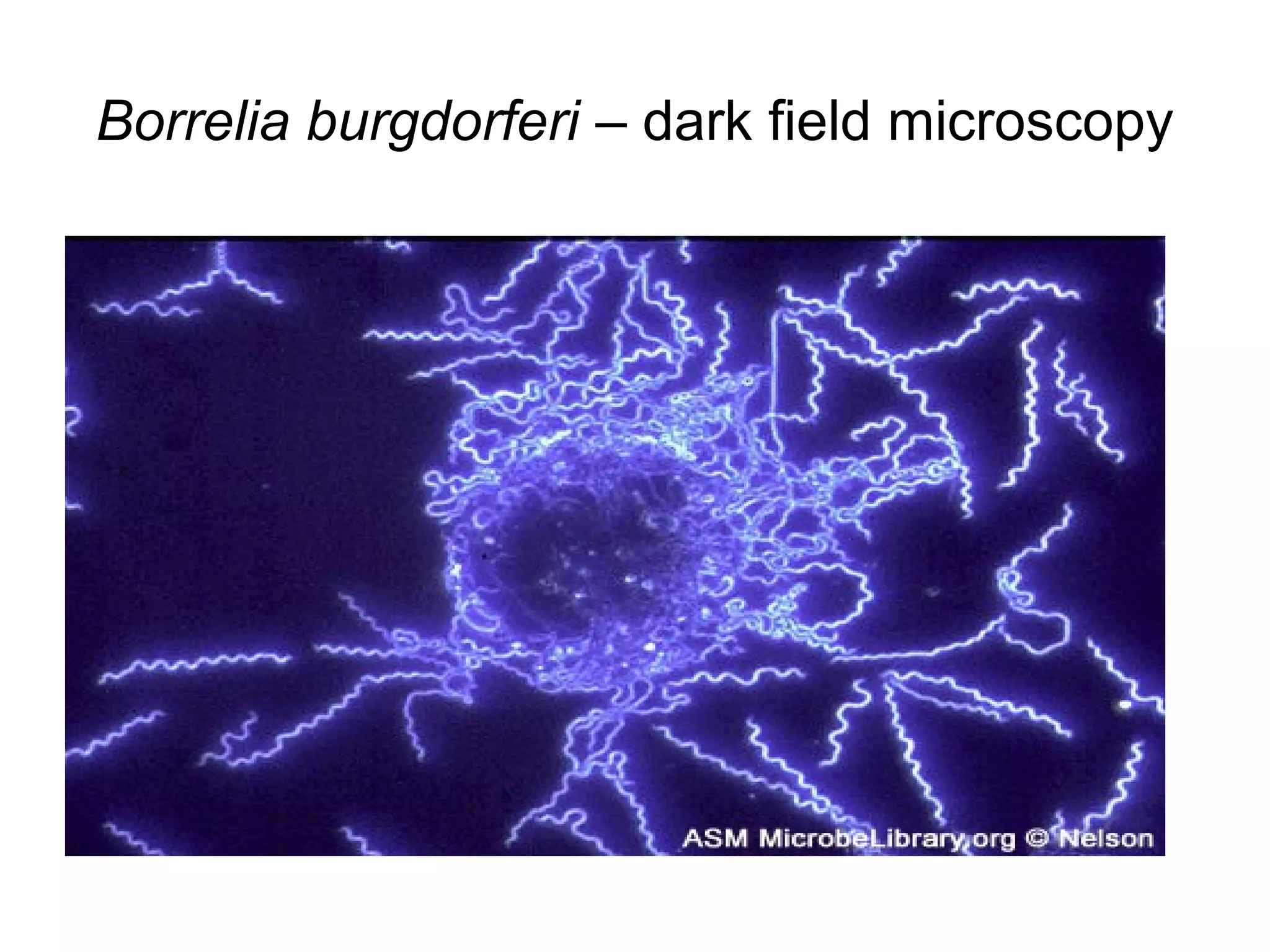 Macroscopic and microscopic examination in bacteriology | PPT