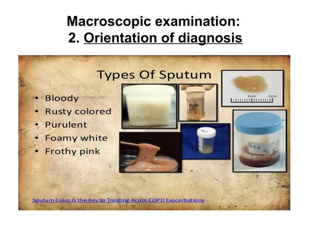 Macroscopic and microscopic examination in bacteriology | PPT