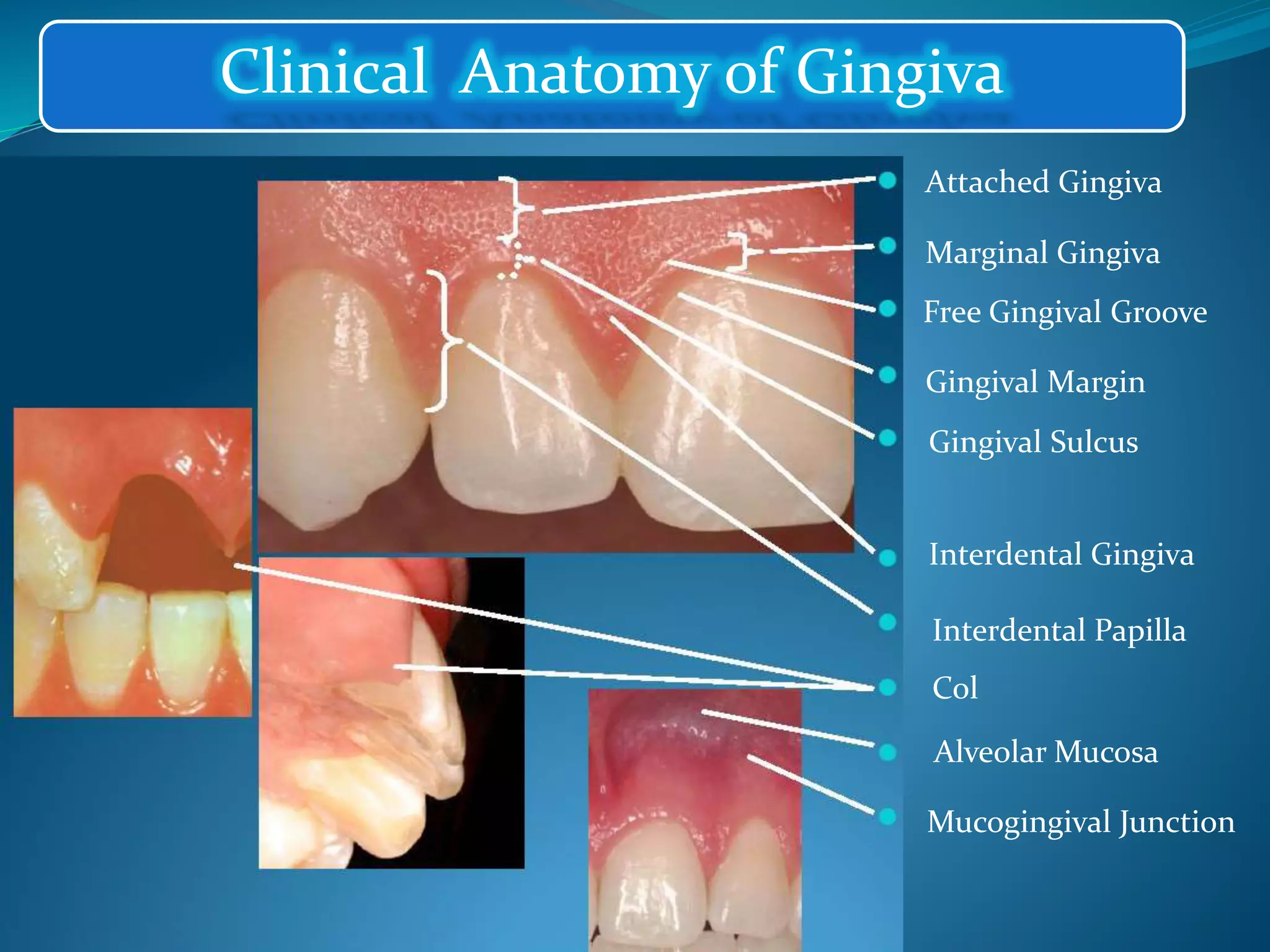 Macroscopic features of gingiva | PPTX