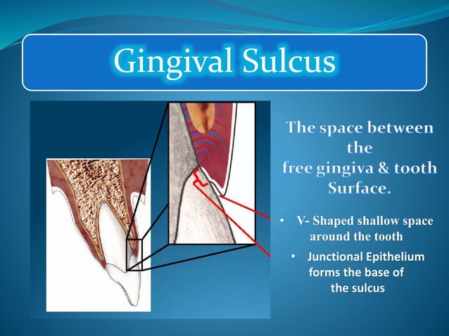 Macroscopic features of gingiva | PPTX | Dental Health | Diseases and ...
