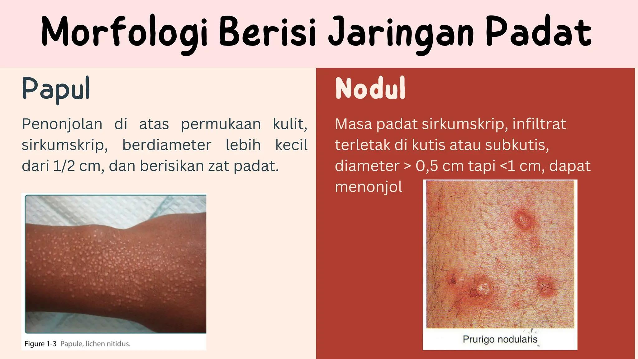 Ppt Macroscopic Structure of Skin Rash.pdf