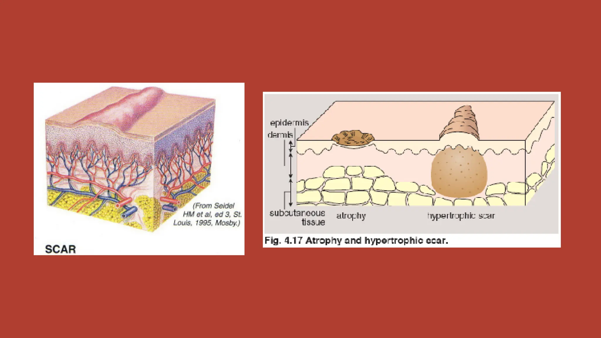 Ppt Macroscopic Structure of Skin Rash.pdf