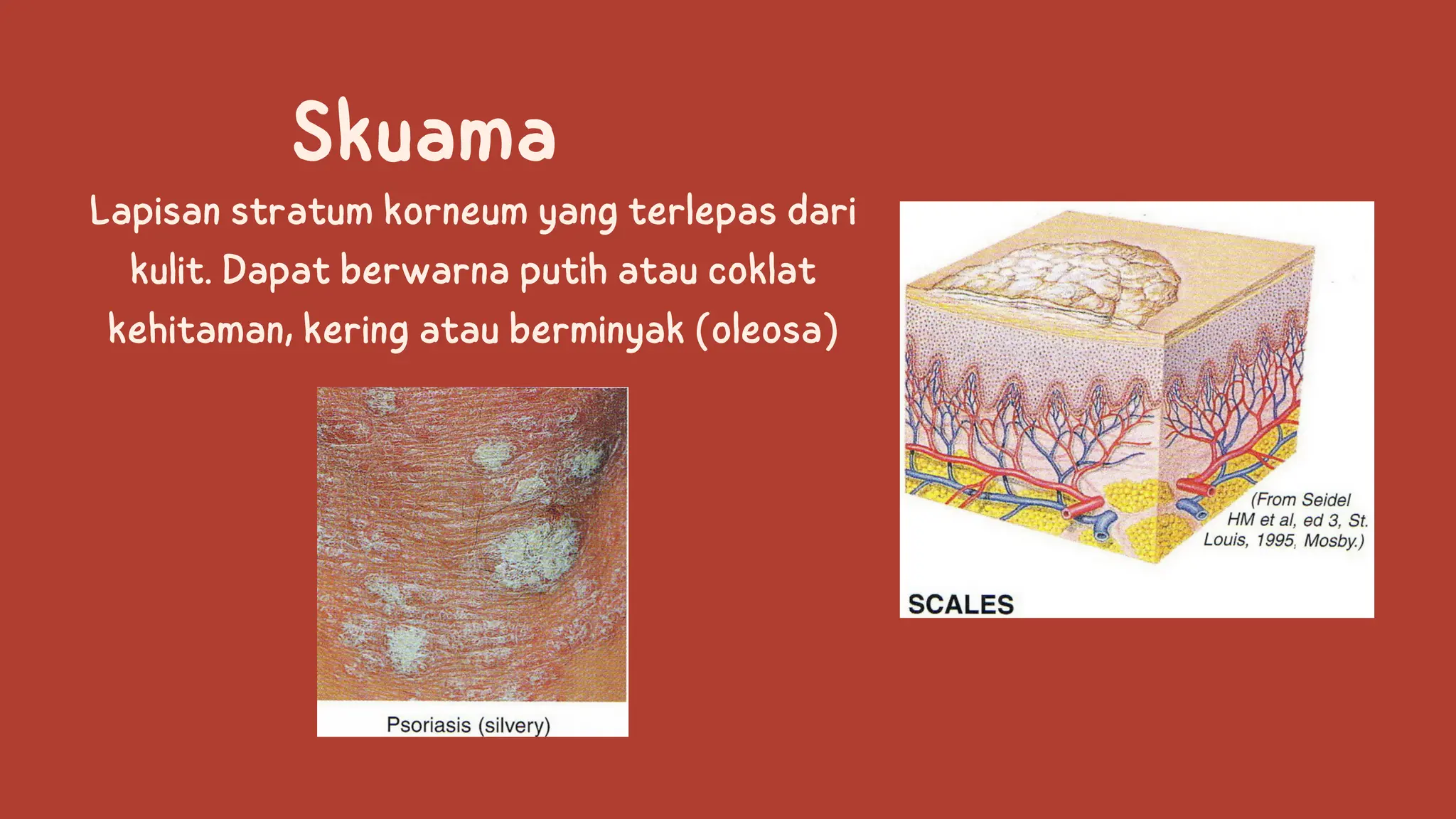 Ppt Macroscopic Structure of Skin Rash.pdf