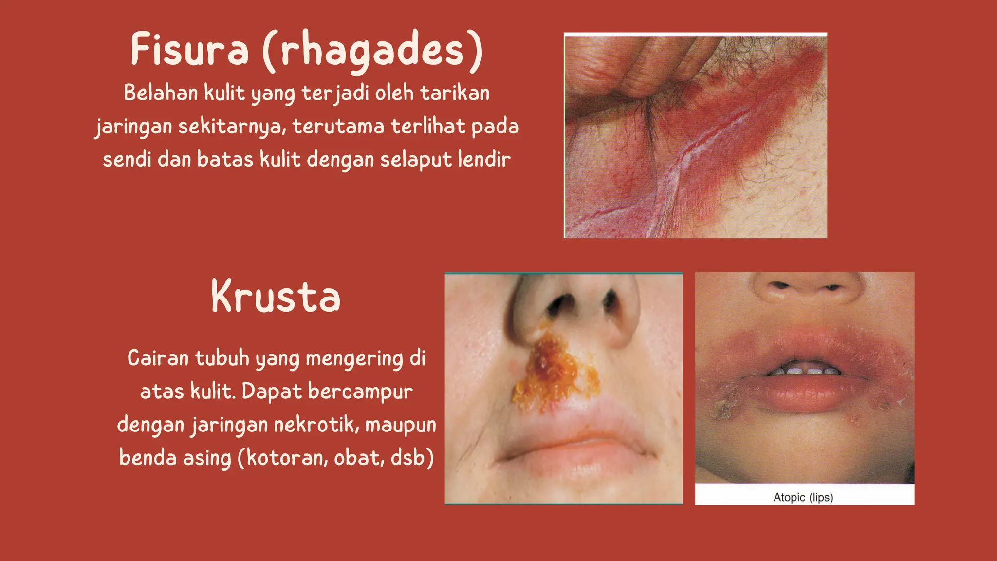 Ppt Macroscopic Structure of Skin Rash.pdf