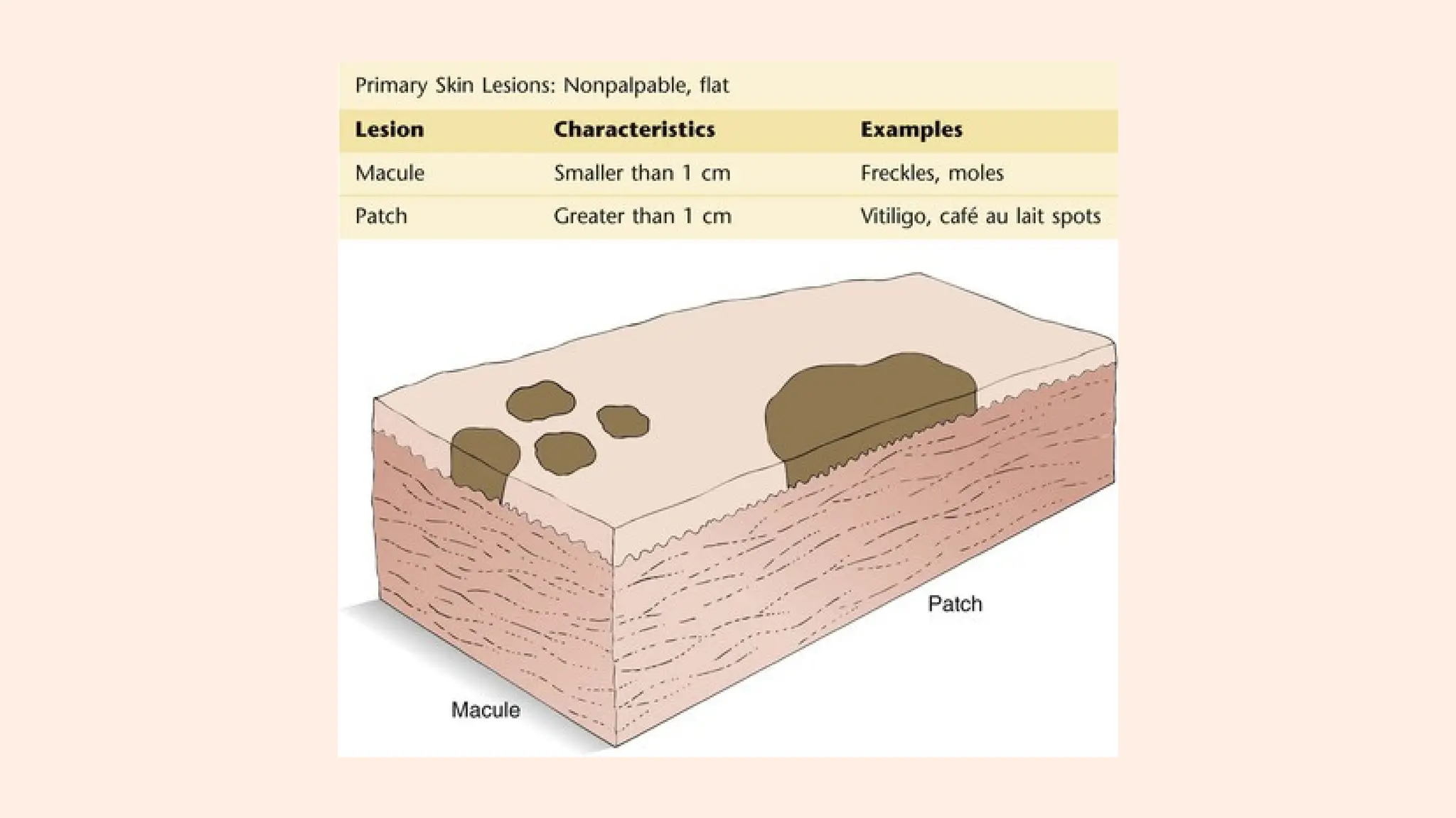 Ppt Macroscopic Structure of Skin Rash.pdf