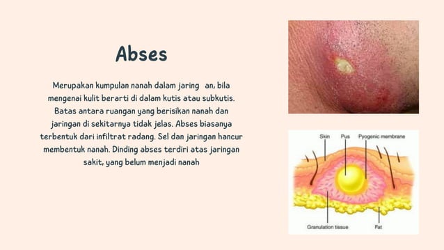 Ppt Macroscopic Structure of Skin Rash.pdf
