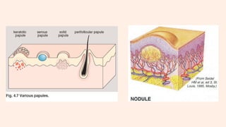 Ppt Macroscopic Structure of Skin Rash.pdf