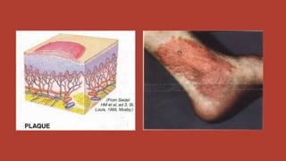 Ppt Macroscopic Structure of Skin Rash.pdf