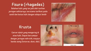 Ppt Macroscopic Structure of Skin Rash.pdf