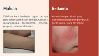 Ppt Macroscopic Structure of Skin Rash.pdf