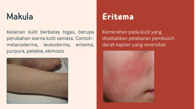 Ppt Macroscopic Structure of Skin Rash.pdf