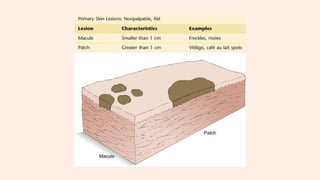 Ppt Macroscopic Structure of Skin Rash.pdf