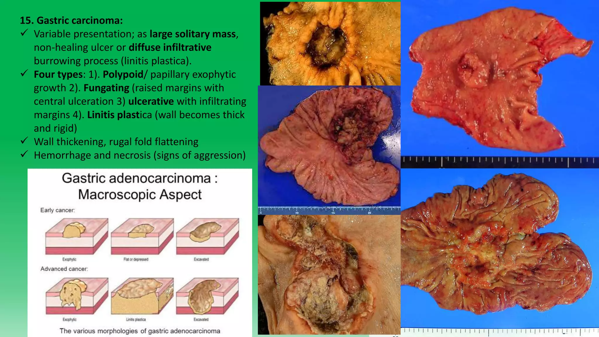 PMU third/fourth year Clinical pathoanatomy Part 3 | PPTX