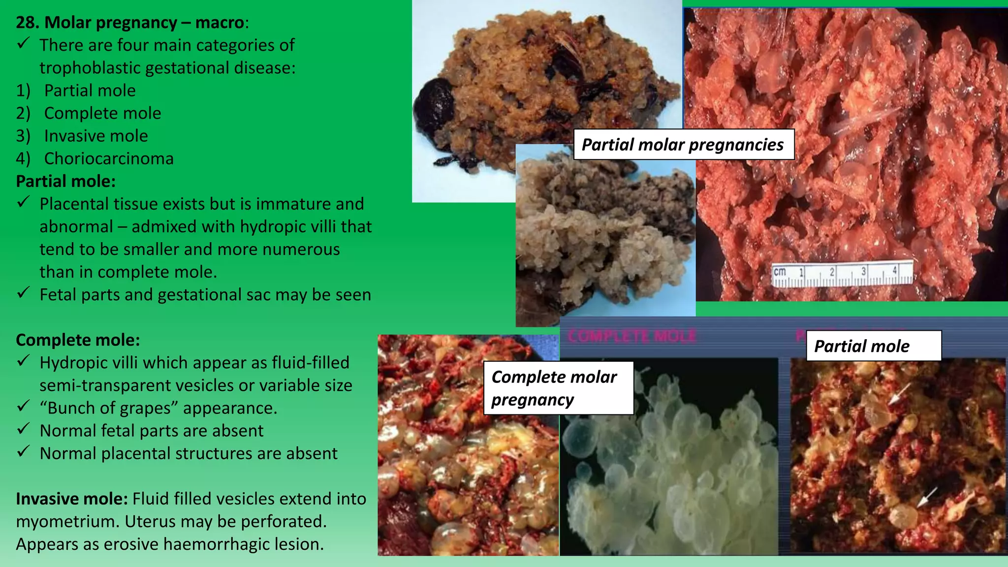 PMU third/fourth year Clinical pathoanatomy Part 3 | PPTX