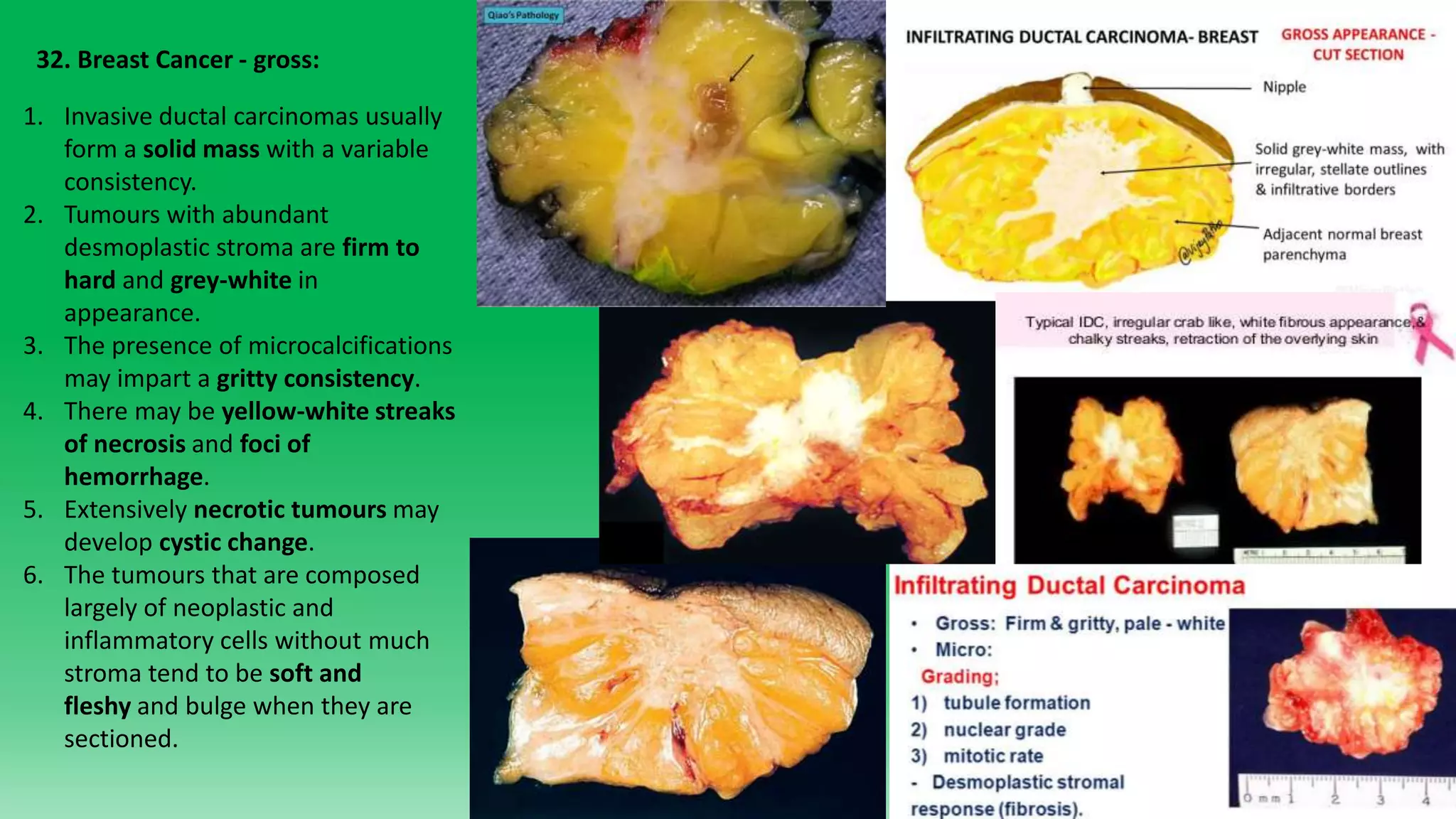 PMU third/fourth year Clinical pathoanatomy Part 3 | PPTX