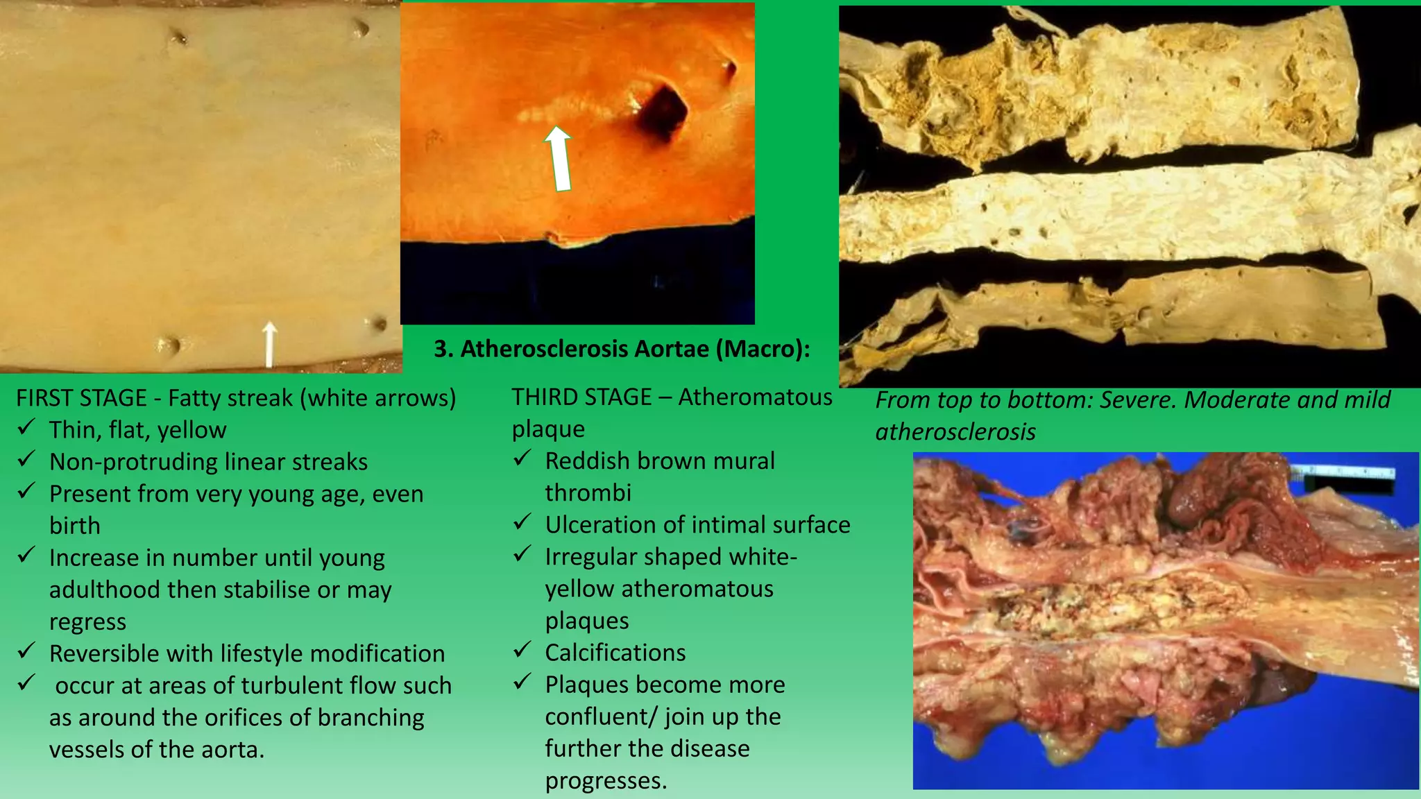 PMU third/fourth year Clinical pathoanatomy Part 3 | PPTX