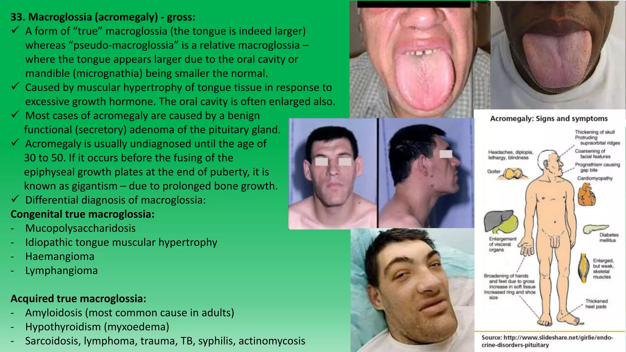 PMU third/fourth year Clinical pathoanatomy Part 3 | PPTX